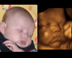 That's My Baby Ultrasound - 3d & 4d in Bowie, Maryland